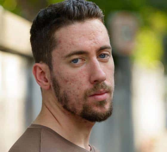 Comparativo de soluciones para el exceso de sebo diciembre 2025