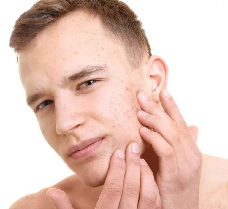 Comparativo de soluciones para el exceso de sebo diciembre 2025